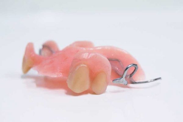 Acrylic Dentures Tweed Heads | Affordable, Custom Acrylic Dentures