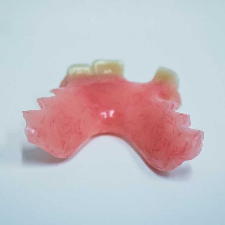 Flexible Dentures Tweed Heads | Affordable, Custom Flexible Dentures